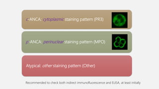 Vasculitis presentation final | PPT