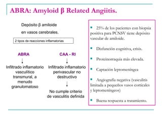 Vasculitis primaria del sistema nervioso central | PPT
