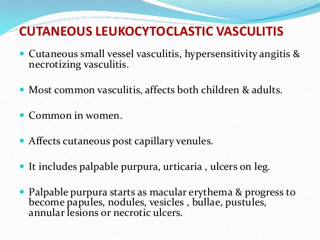 Cutaneous Vasculitis