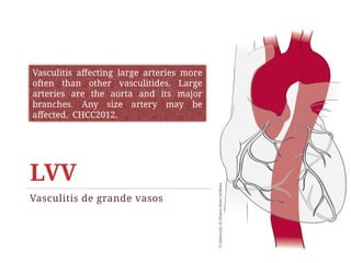 Vasculitis sistémicas, reumatologia.pptx