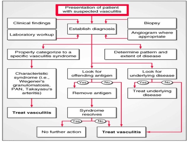Vasculitis syndrome an approach -and-basic principles of treatment