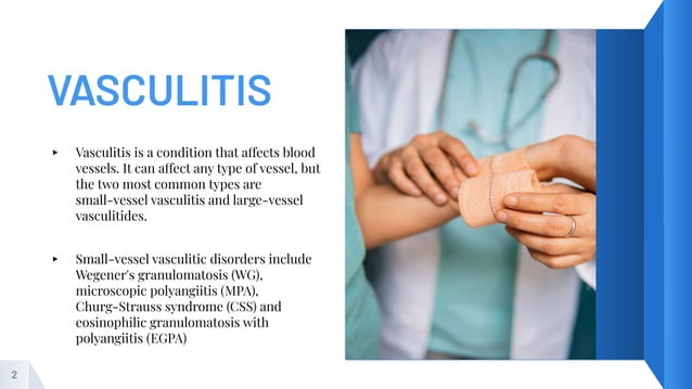 Vasculitis Treatment in Coimbatore.pdf