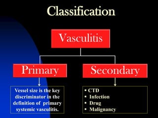 Vasculitis undergrad: diagnosis & treatment. | PDF