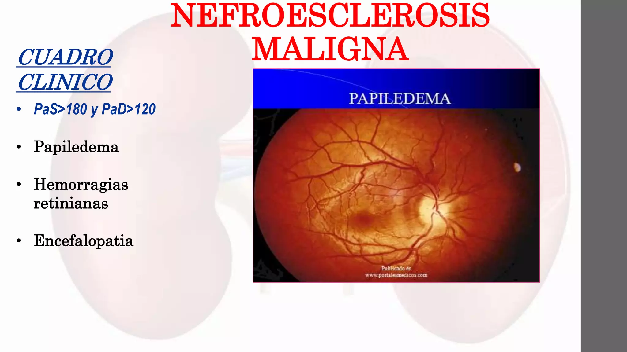 Vasculopatias renales | PPT