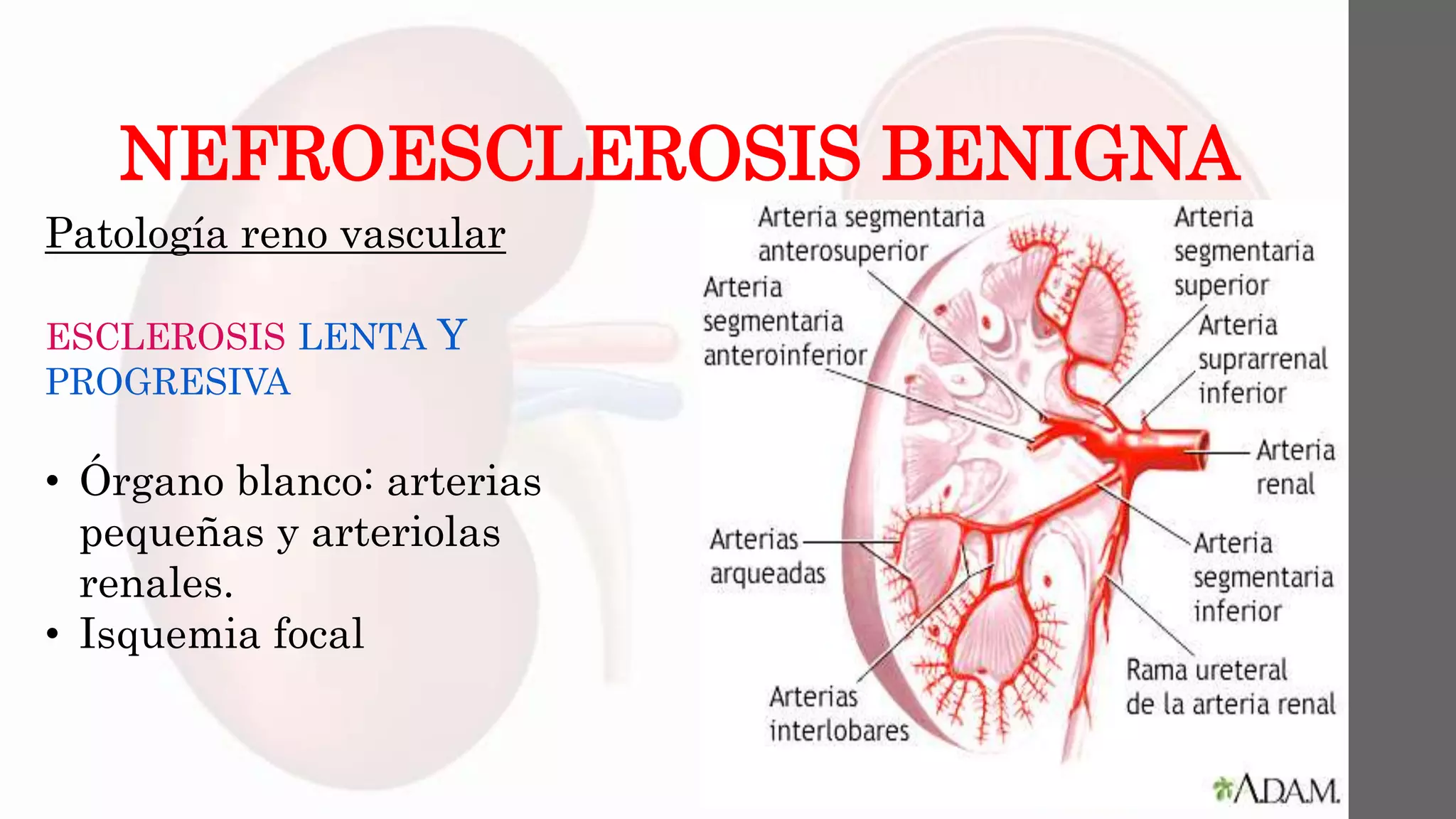 Vasculopatias renales | PPT