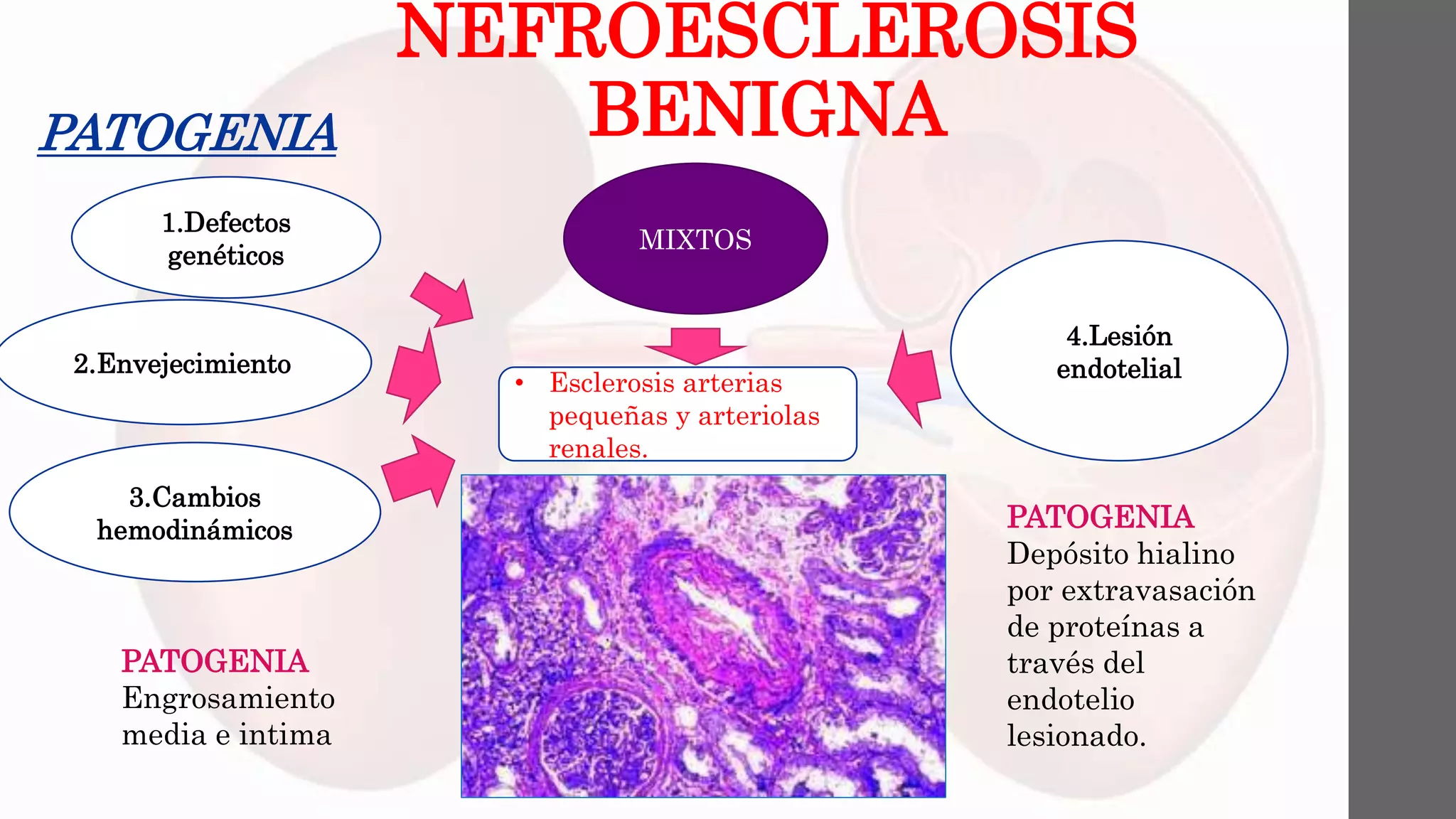 Vasculopatias renales | PPT