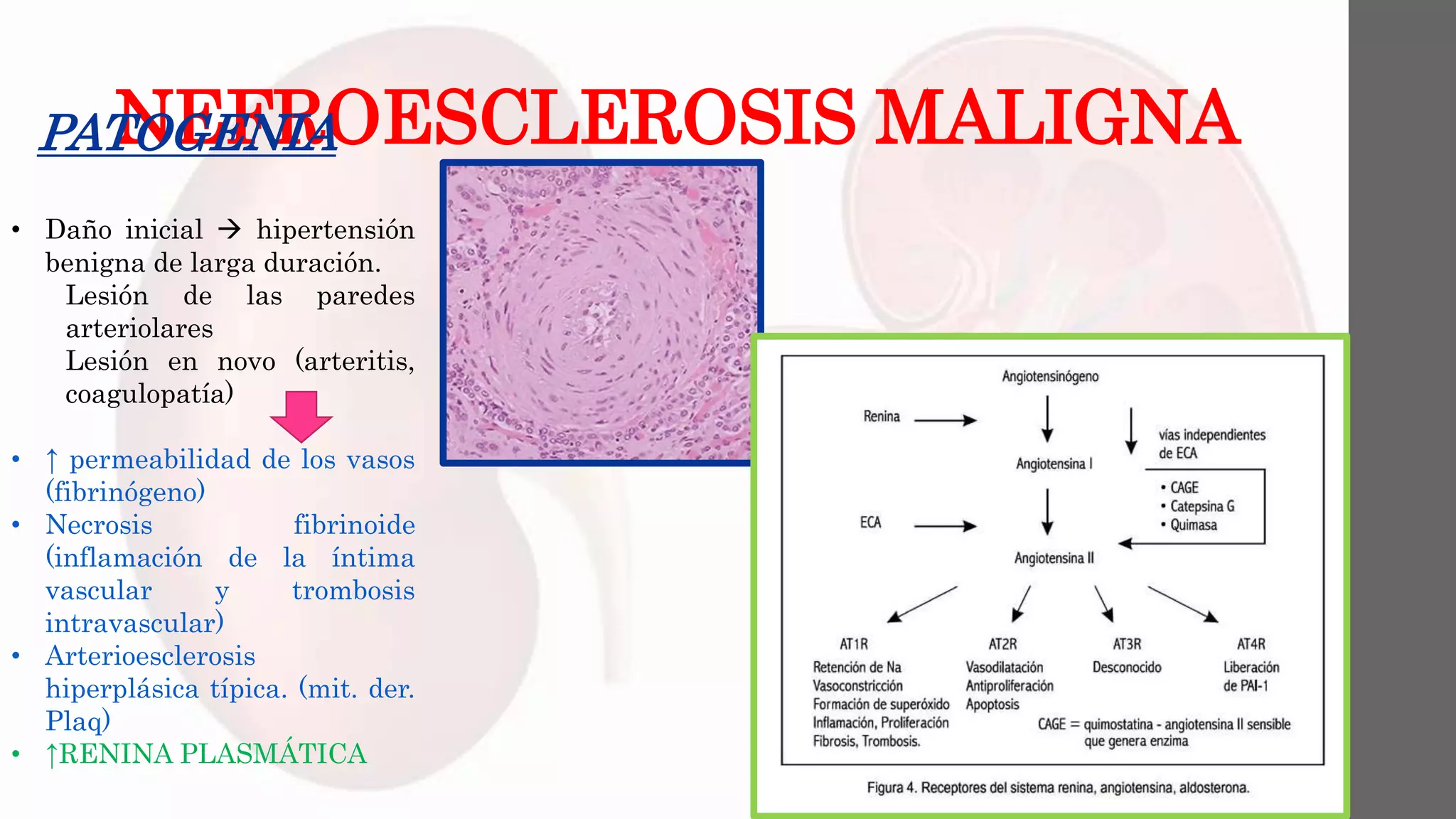 Vasculopatias renales | PPT