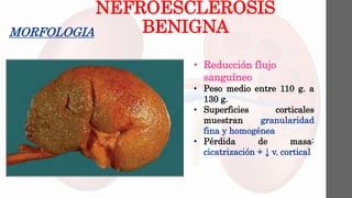 Vasculopatias renales | PPTX