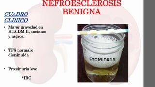 Vasculopatias renales | PPTX