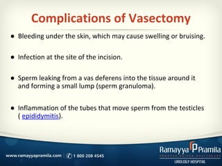 Vasectomy | PDF