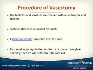 Vasectomy | PDF