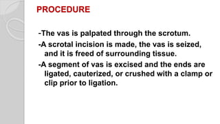 Vasectomy | PPTX