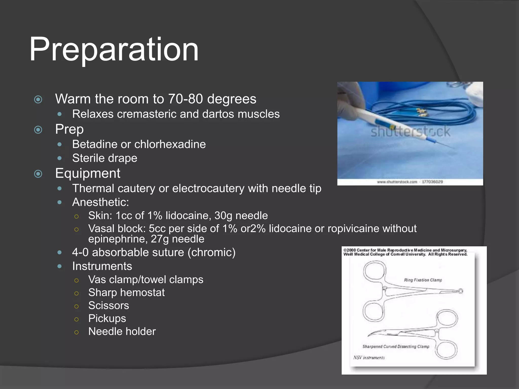 Vasectomy.pptx