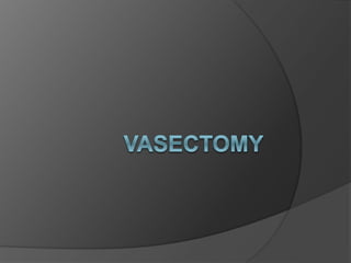 Vasectomy.pptx