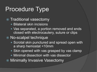 Vasectomy.pptx