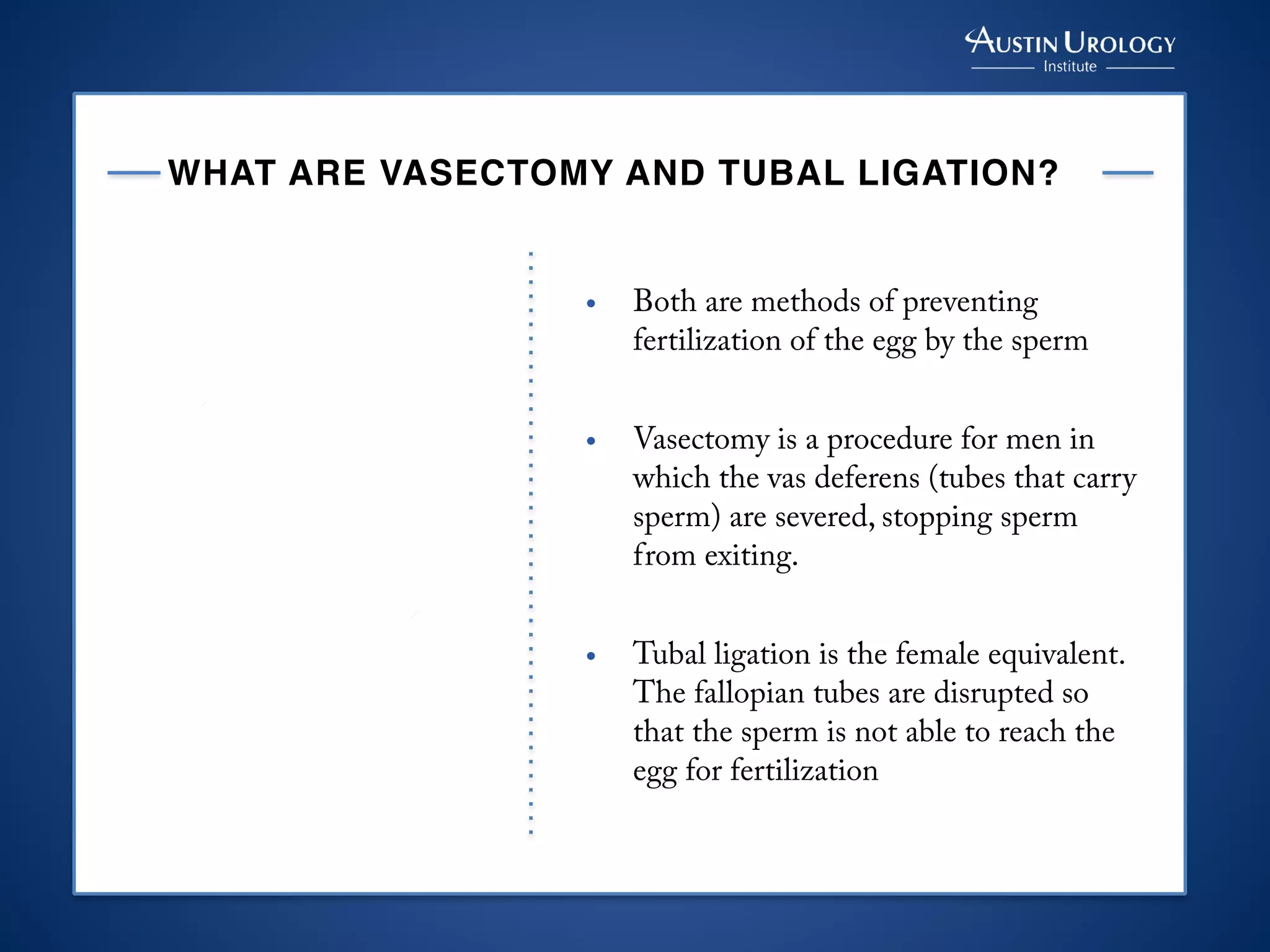 Vasectomy vs. Tubal Ligation | PDF