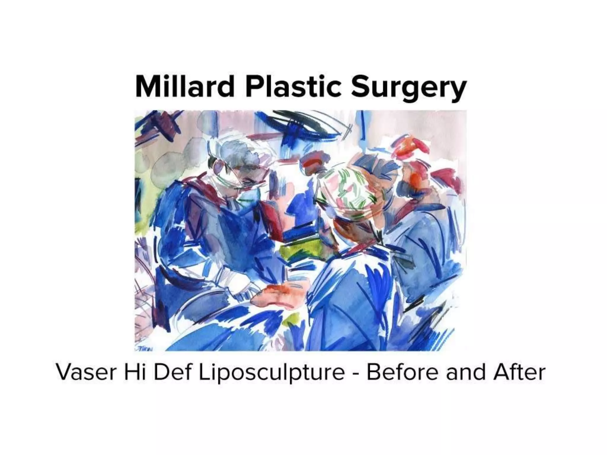 Vaser Hi-Def Liposculpture Before And After | PPT