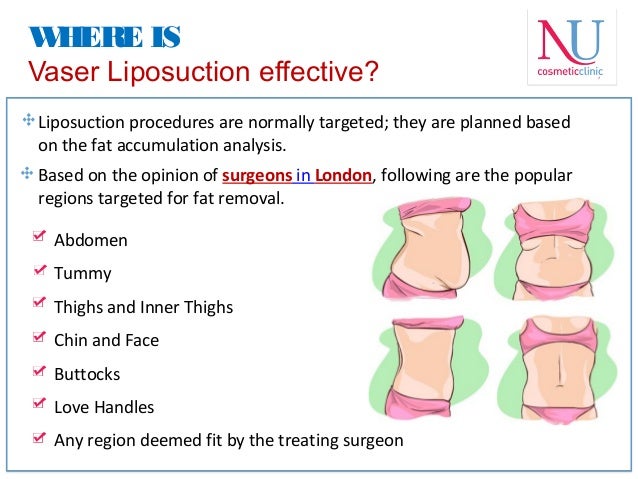 Vaser Liposuction for Everyone Hopeful about a Better Tomorrow