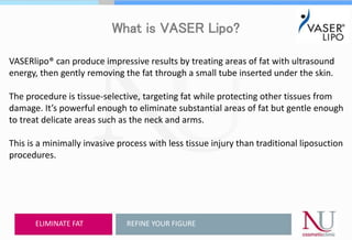 Vaser liposuction | PPTX