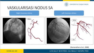 Vaskularisasi sistem konduksi jantung.pdf
