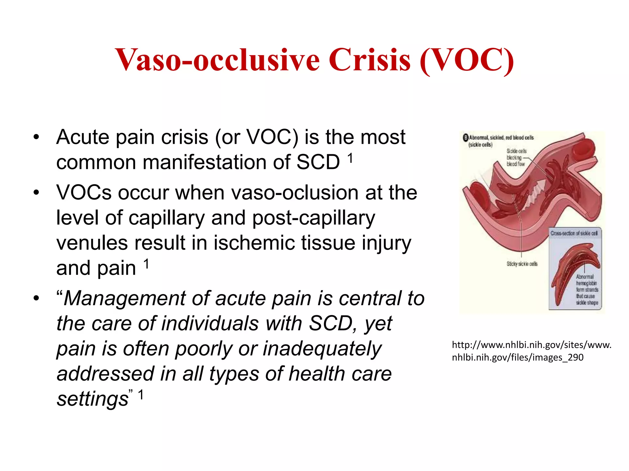 Vaso-occlusive Crisis.pptx | Physical Therapy | Wellness