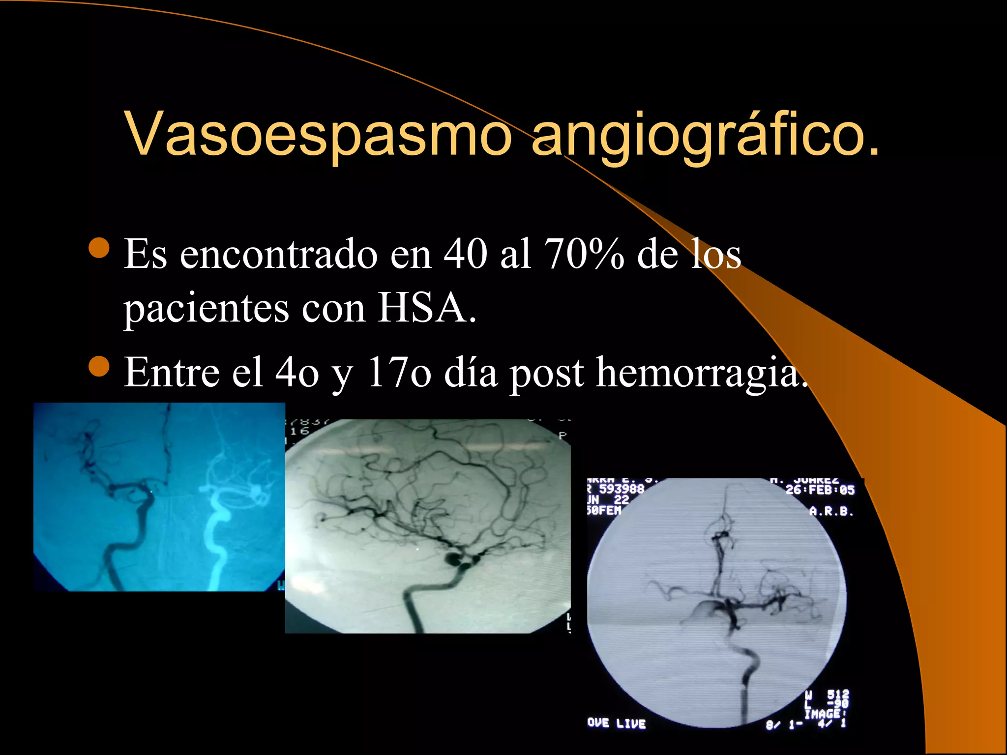 Vasoespasmo arterial cerebral. Fundamentos. | PPT
