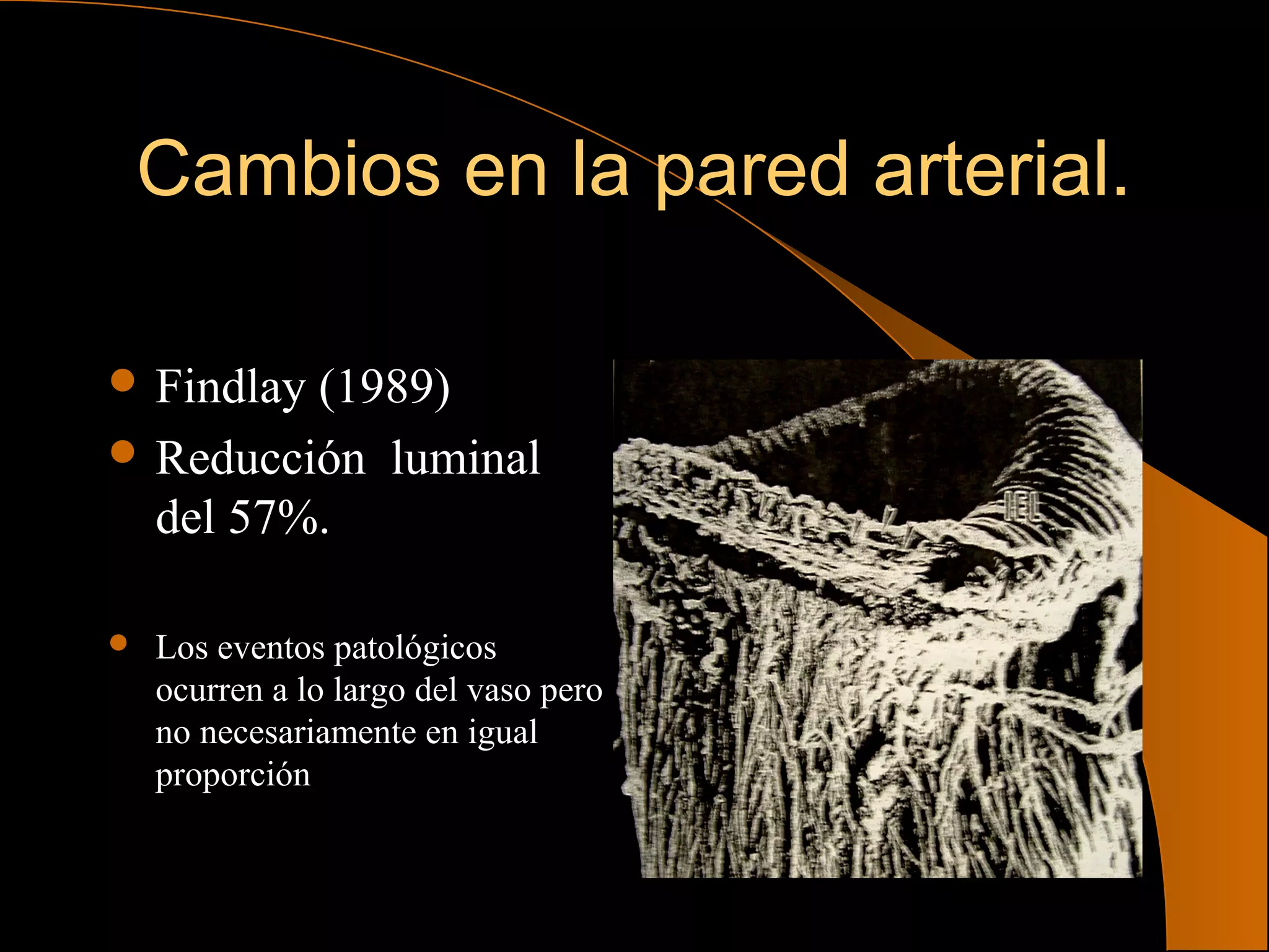 Vasoespasmo arterial cerebral. Fundamentos. | PPT