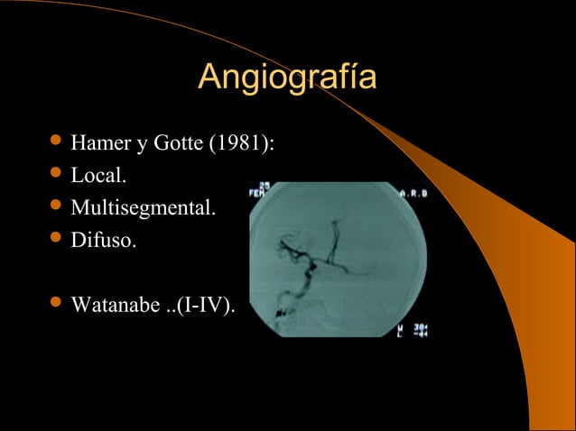Vasoespasmo arterial cerebral. Fundamentos. | PPT