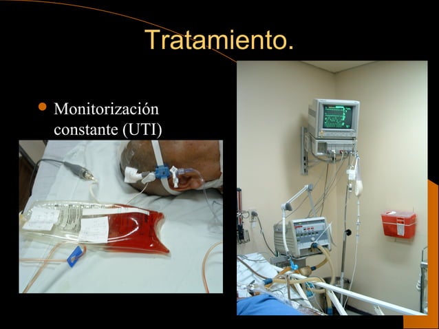 Vasoespasmo arterial cerebral. Fundamentos. | PPT