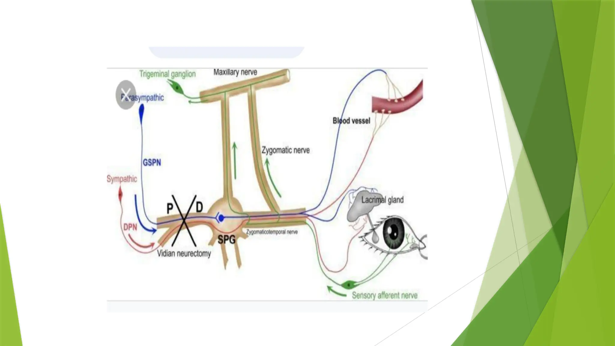 VASOMOTOR AND OTHER FORMS OF NON-ALLERGIC RHINITIS NEW.pptx