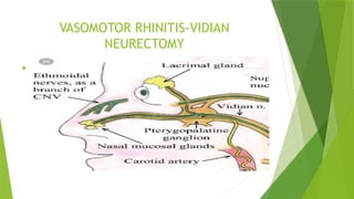 VASOMOTOR AND OTHER FORMS OF NON-ALLERGIC RHINITIS NEW.pptx