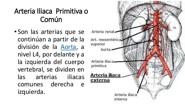 Iliaca
