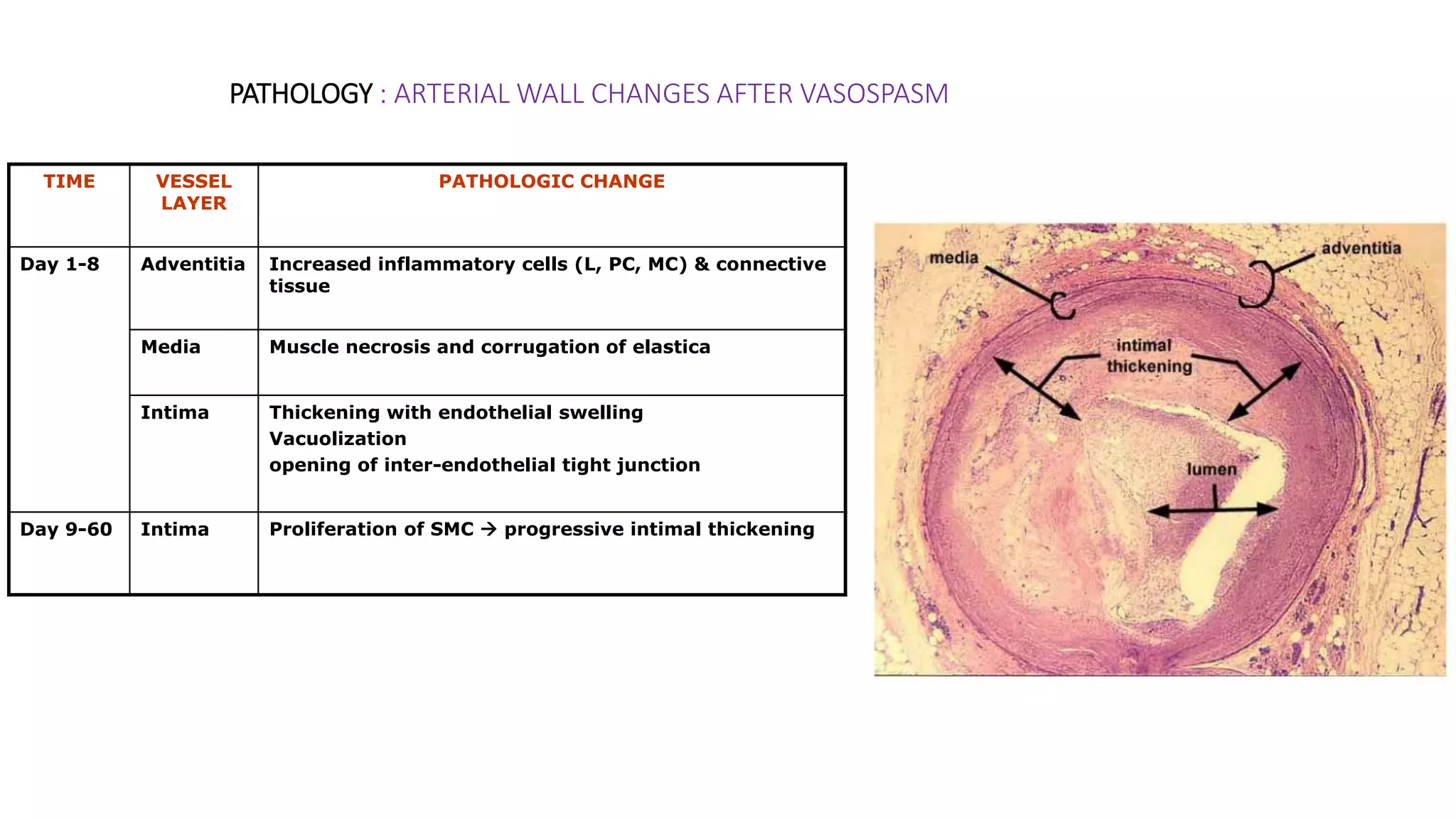 Vasospasm in subarachnoid haemorrhage pre finale | PPTX