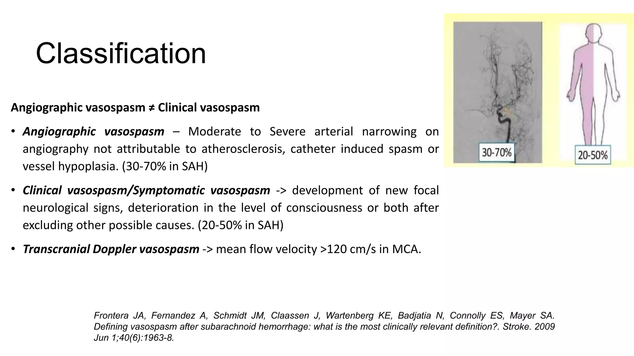 Vasospasm in subarachnoid haemorrhage pre finale | PPTX
