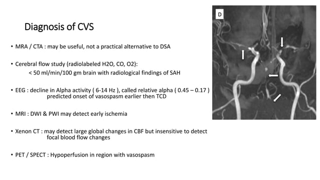 Vasospasm in subarachnoid haemorrhage pre finale | PPTX | Brain and ...