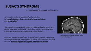 Vasospastic disorders (vascular disorders) | PPTX