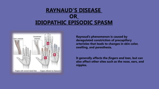 Vasospastic disorders (vascular disorders) | PPTX