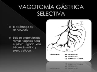 Vasos y nervios del estomago | PPTX