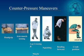 Vasovagal syncope management Mexico City 2016 | PPT