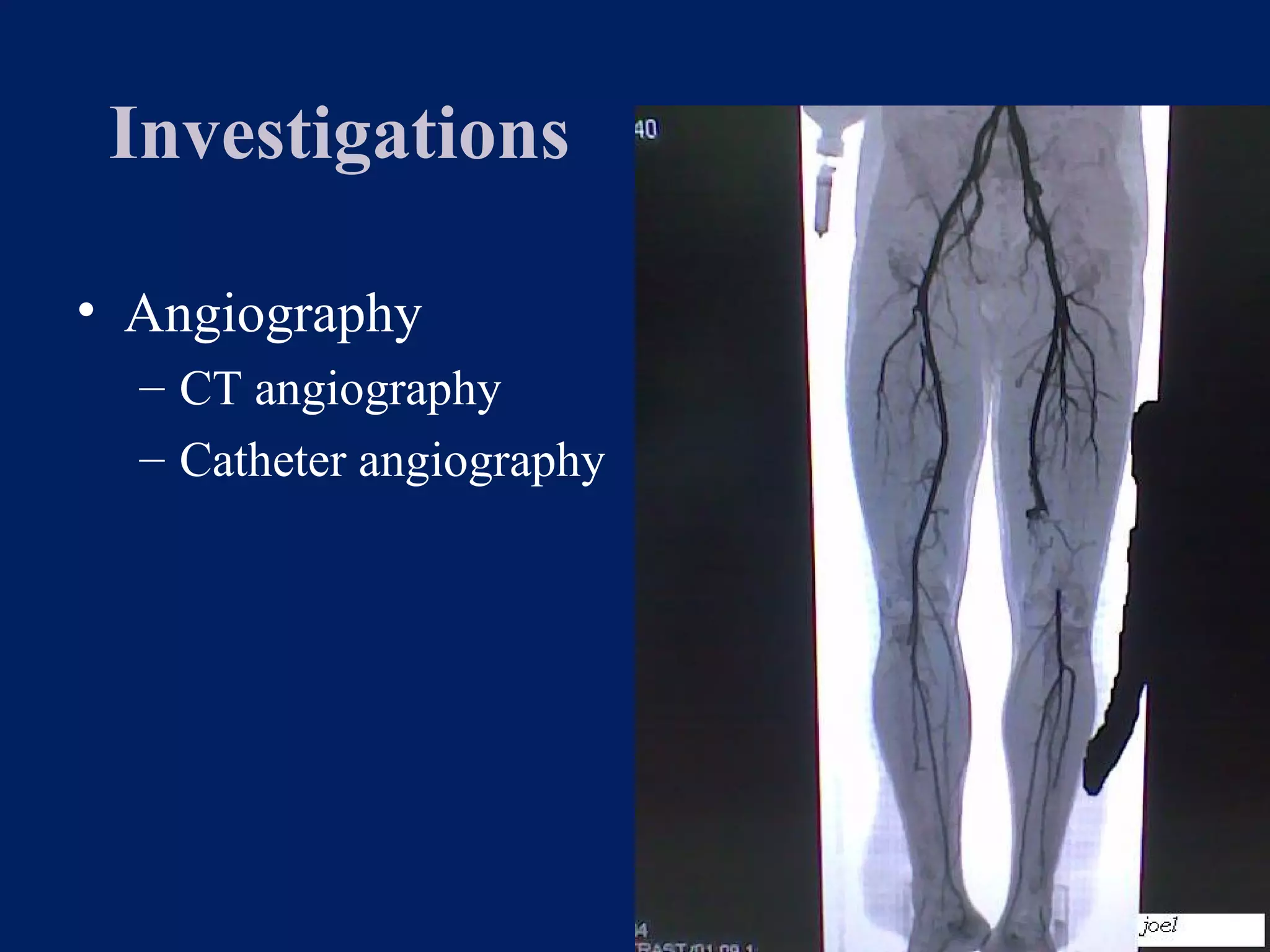 extremity Vascular trauma / injury | PPT