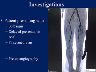 extremity Vascular trauma / injury | PPT