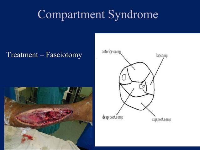 extremity Vascular trauma / injury | PPT
