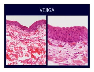 Histología De La Vejiga