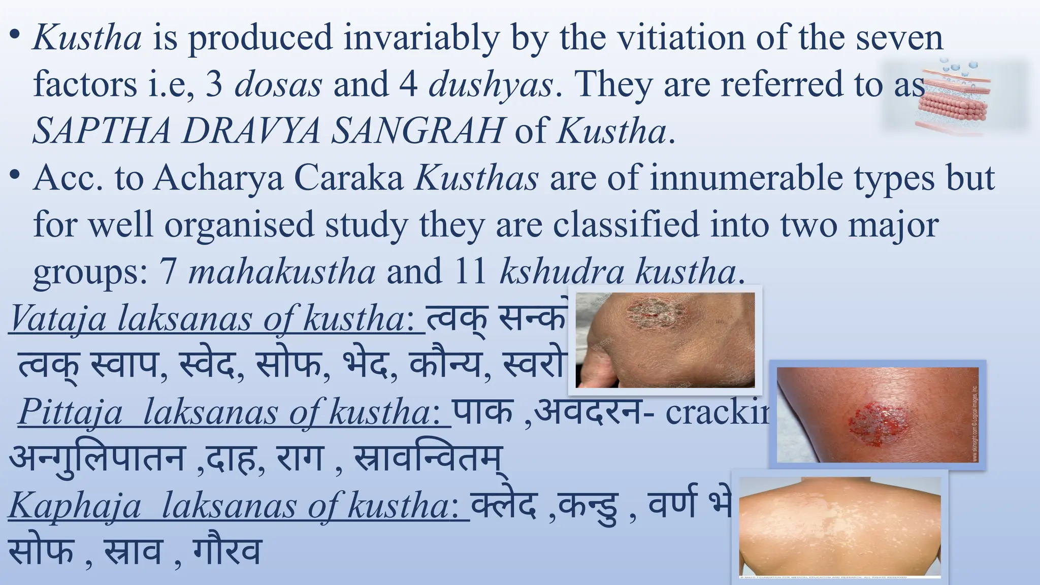 'Vatottrareshu Sarpi' in kustha chikitsa presentation.pptx