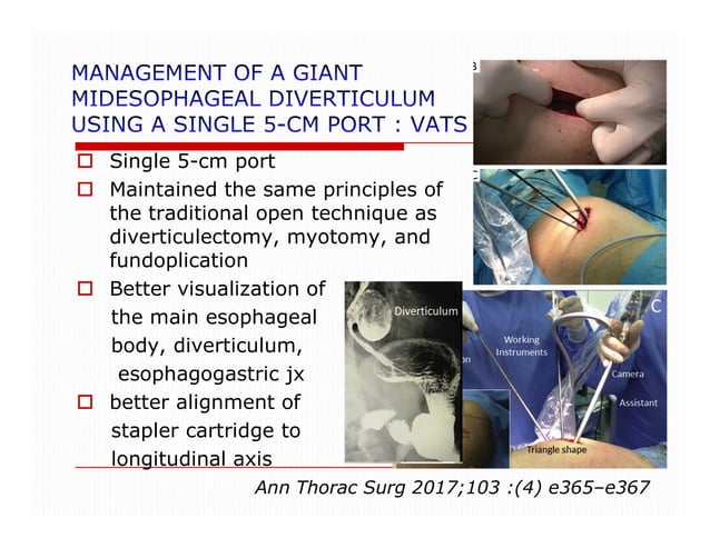 VATS Dr K S chalam | PPT