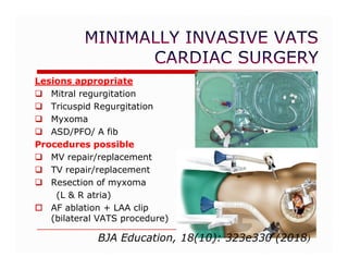 VATS Dr K S chalam | PPT