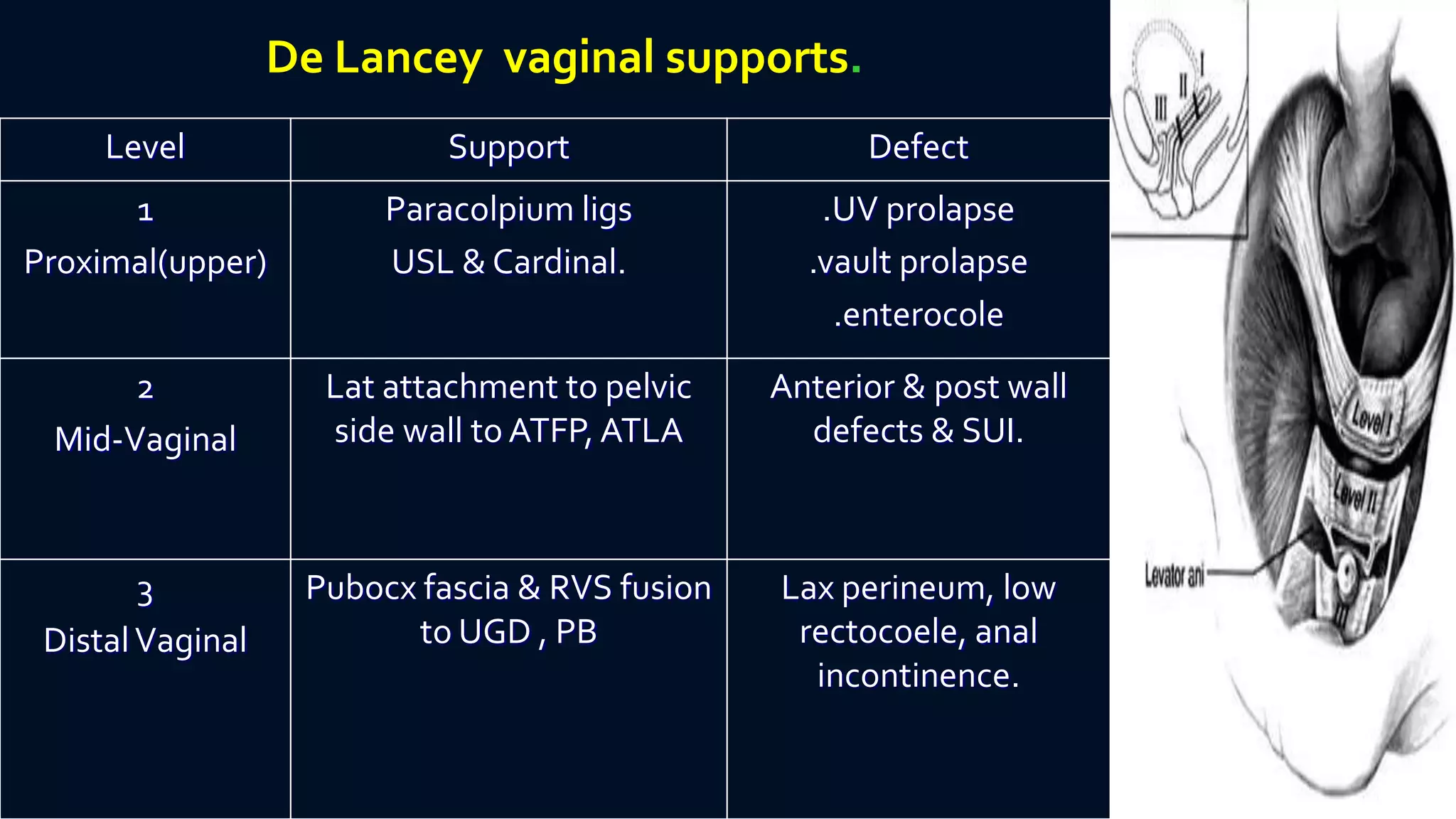 Vault prolapse, Pelvic organ Prolapse, Supports Of Uterus | PPSX