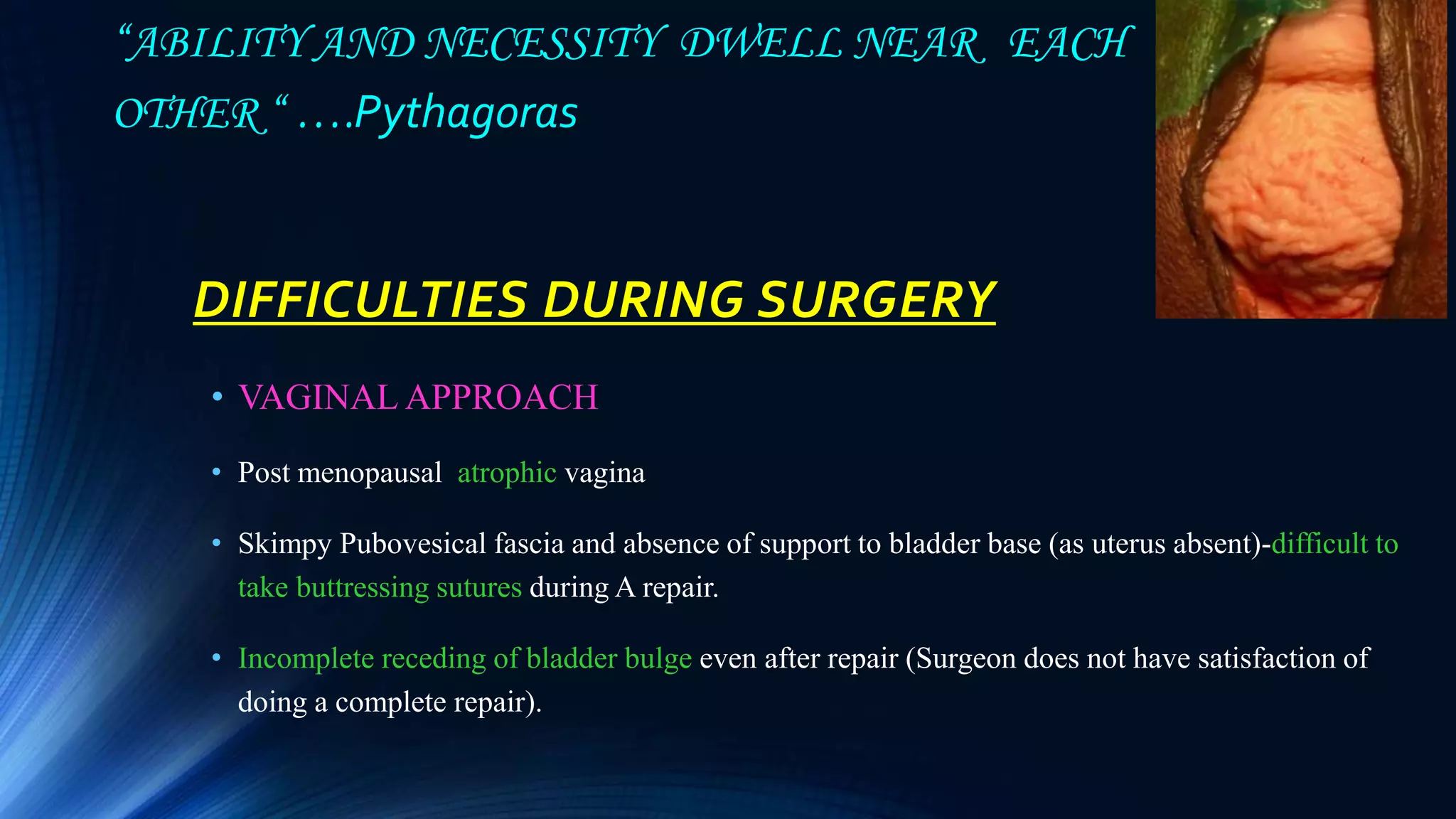 Vault prolapse, Pelvic organ Prolapse, Supports Of Uterus | PPSX