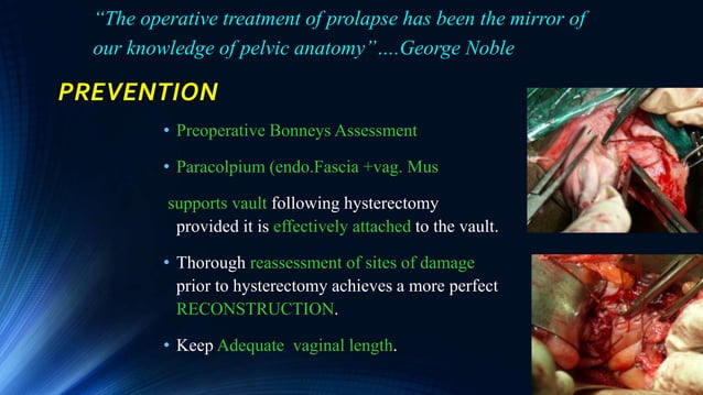 Vault prolapse, Pelvic organ Prolapse, Supports Of Uterus | PPSX