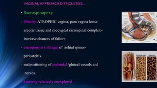 Vault Prolapse Pelvic Organ Prolapse Supports Of Uterus